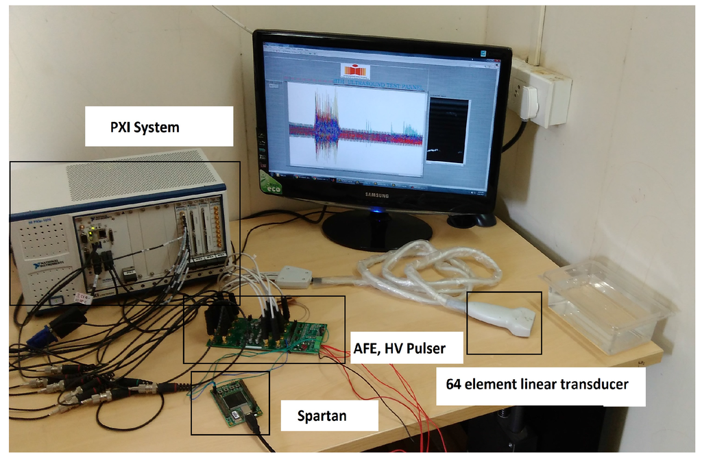 J. Imaging | Free Full-Text | FPGA-Based Portable Ultrasound Scanning ...