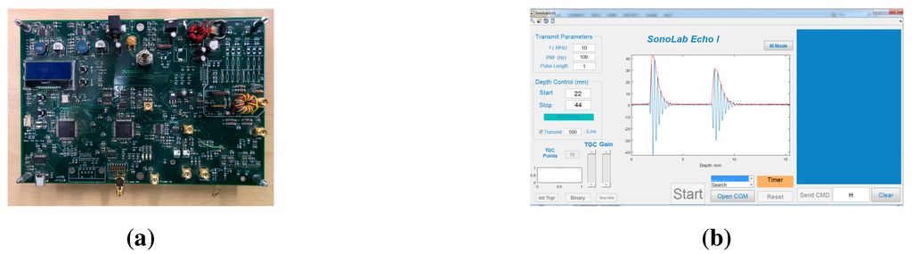 FPGA-Based Portable Ultrasound Scanning System with Automatic Kidney ...