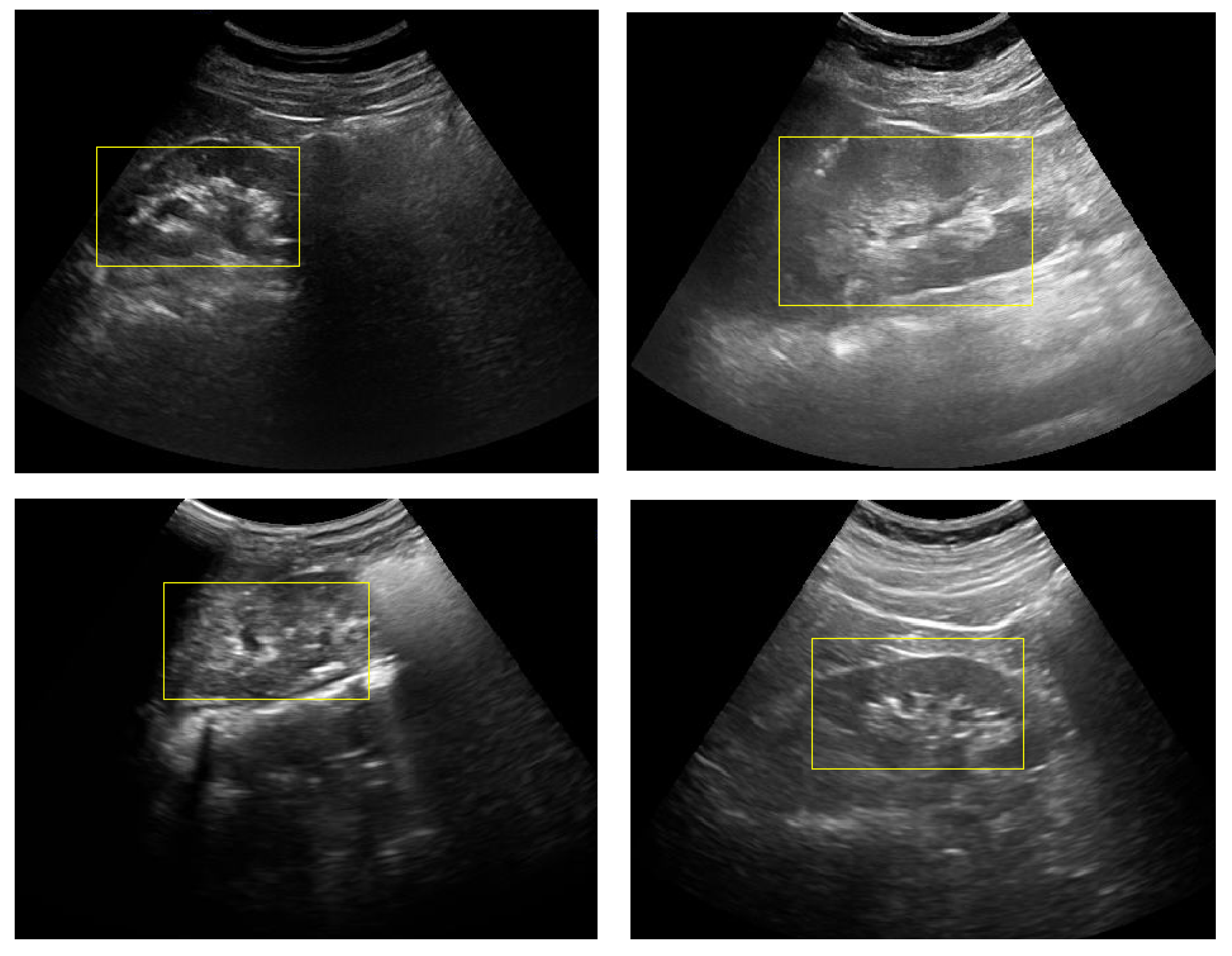 FPGA-Based Portable Ultrasound Scanning System with Automatic Kidney ...