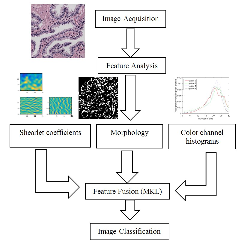 J. Imaging | Free Full-Text | Automatic Gleason Grading of Prostate Cancer Using Shearlet ...
