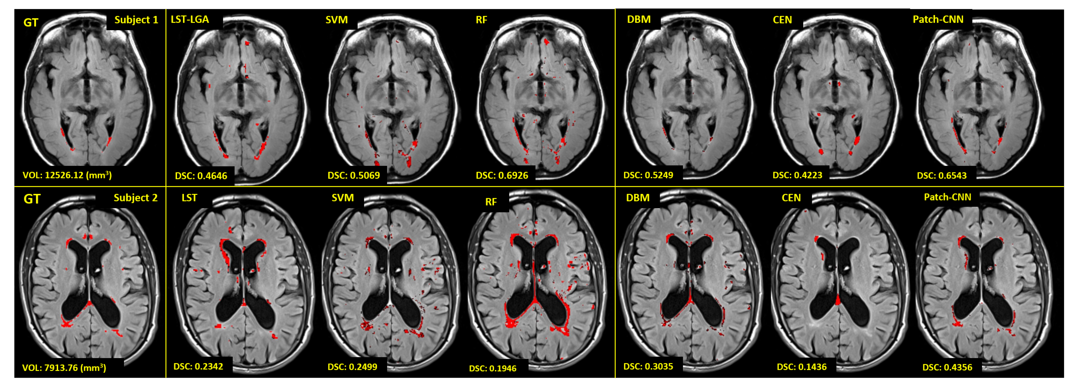 J. Imaging | Free Full-Text | Deep Learning vs. Conventional Machine ...