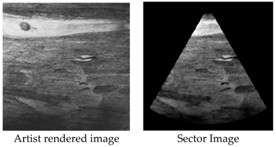 Texture Based Quality Analysis of Simulated Synthetic Ultrasound Images Using Local Binary Patterns