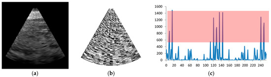 Texture Based Quality Analysis of Simulated Synthetic Ultrasound Images Using Local Binary Patterns