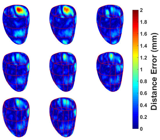 Surface Mesh Reconstruction from Cardiac MRI Contours