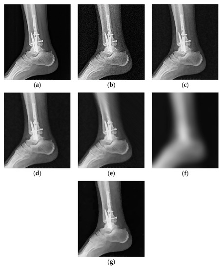 J. Imaging | Free Full-Text | Denoising of X-ray Images Using the Adaptive Algorithm Based on ...
