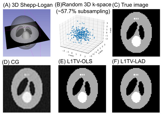 J. Imaging | Free Full-Text | Python Non-Uniform Fast Fourier Transform ...