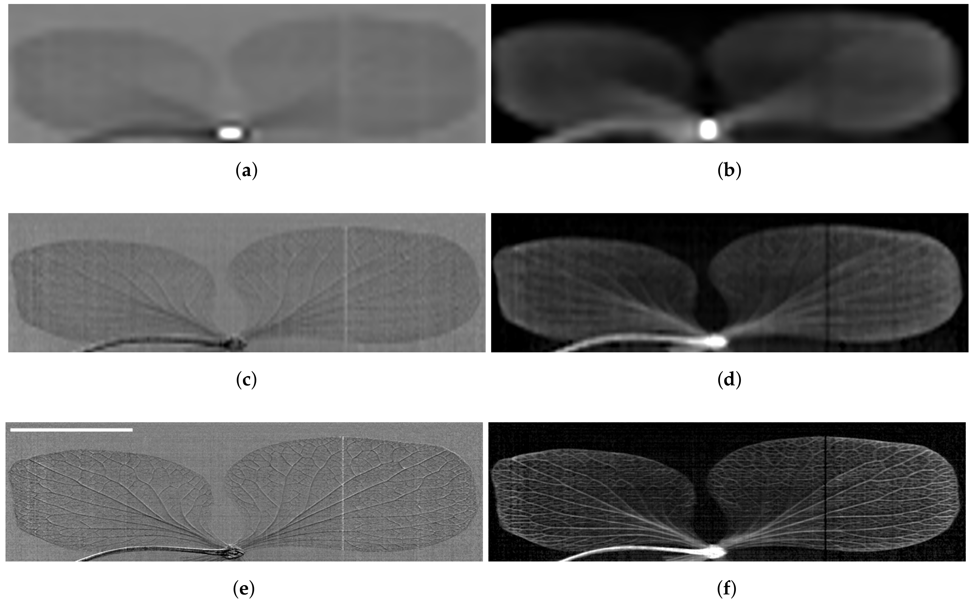 J Imaging Free Full Text Single Shot X Ray Phase Retrieval Through