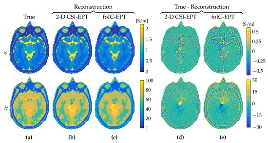 J. Imaging | Free Full-Text | Developments in Electrical-Property Tomography Based on the ...