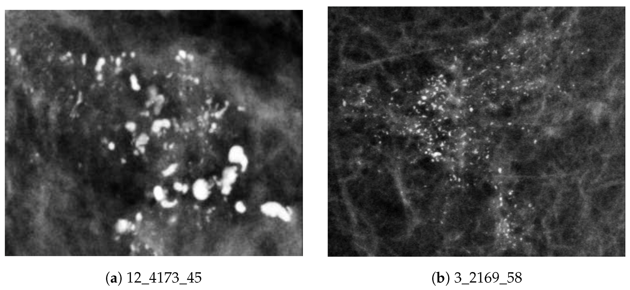 J Imaging Free Full Text Classification Of Microcalcification Clusters In Digital