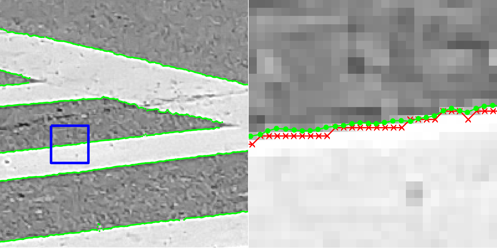 J. Imaging | Free Full-Text | Subpixel Localization of Isolated Edges ...