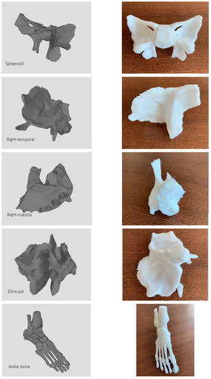 Marching Cubes and Histogram Pyramids for 3D Medical Visualization