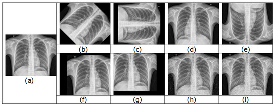 A Survey of Deep Learning for Lung Disease Detection on Medical Images ...