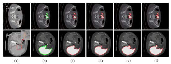 Domain Adaptation for Medical Image Segmentation: A Meta-Learning Method