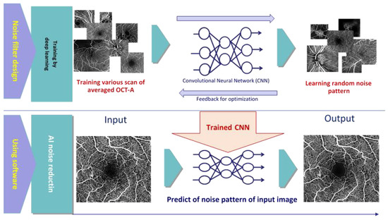 Clinical Utility of Artificial Intelligence Algorithms to Enhance Wide ...