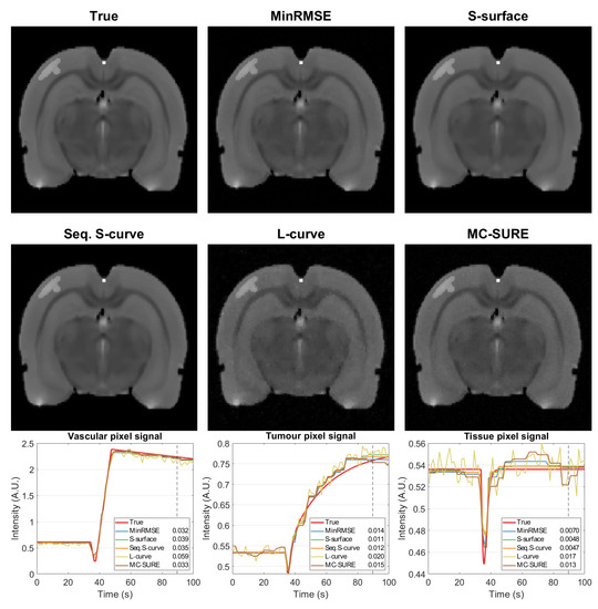 Data-Driven Regularization Parameter Selection in Dynamic MRI