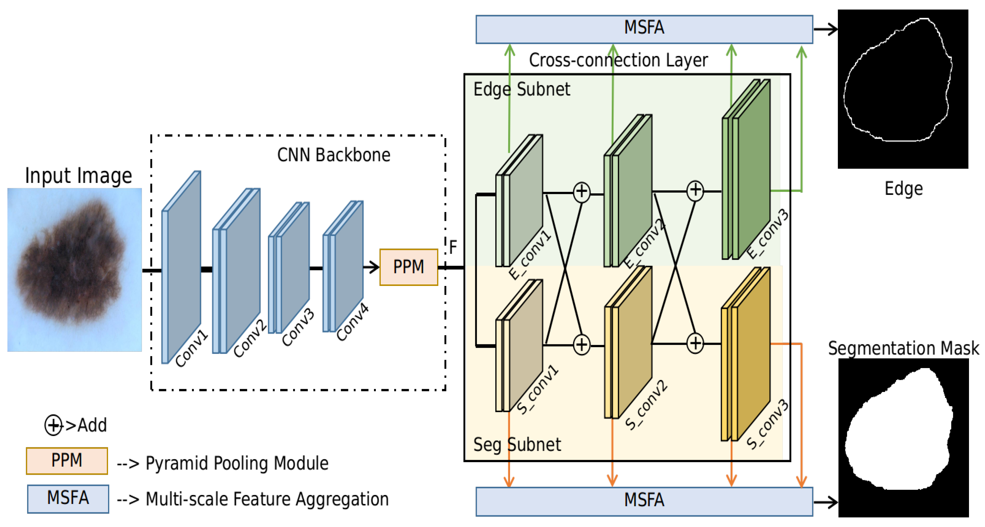 Skin Lesion Segmentation Using Deep Learning with Auxiliary Task