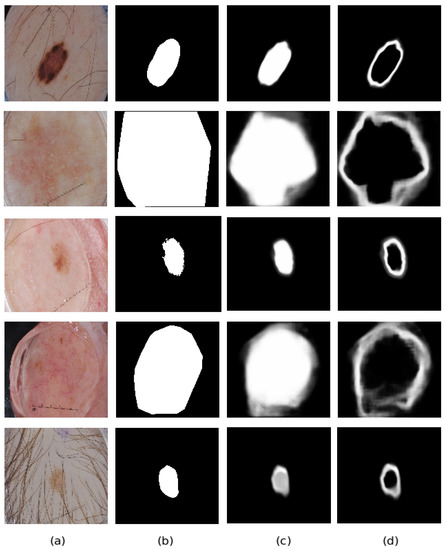 Skin Lesion Segmentation Using Deep Learning with Auxiliary Task