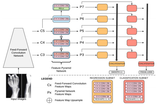 How Can a Deep Learning Algorithm Improve Fracture Detection on X-rays ...