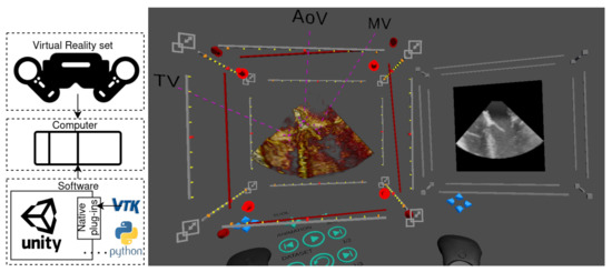 A Virtual Reality System for Improved Image-Based Planning of Complex ...