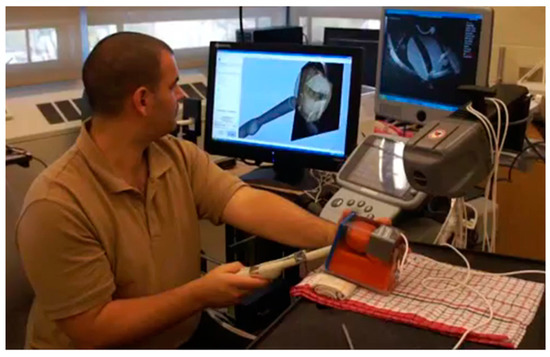 Design of an Ultrasound-Navigated Prostate Cancer Biopsy System for ...