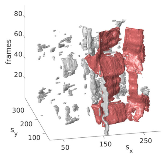 Mitral Valve Segmentation Using Robust Nonnegative Matrix Factorization