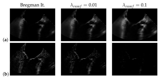 Mitral Valve Segmentation Using Robust Nonnegative Matrix Factorization