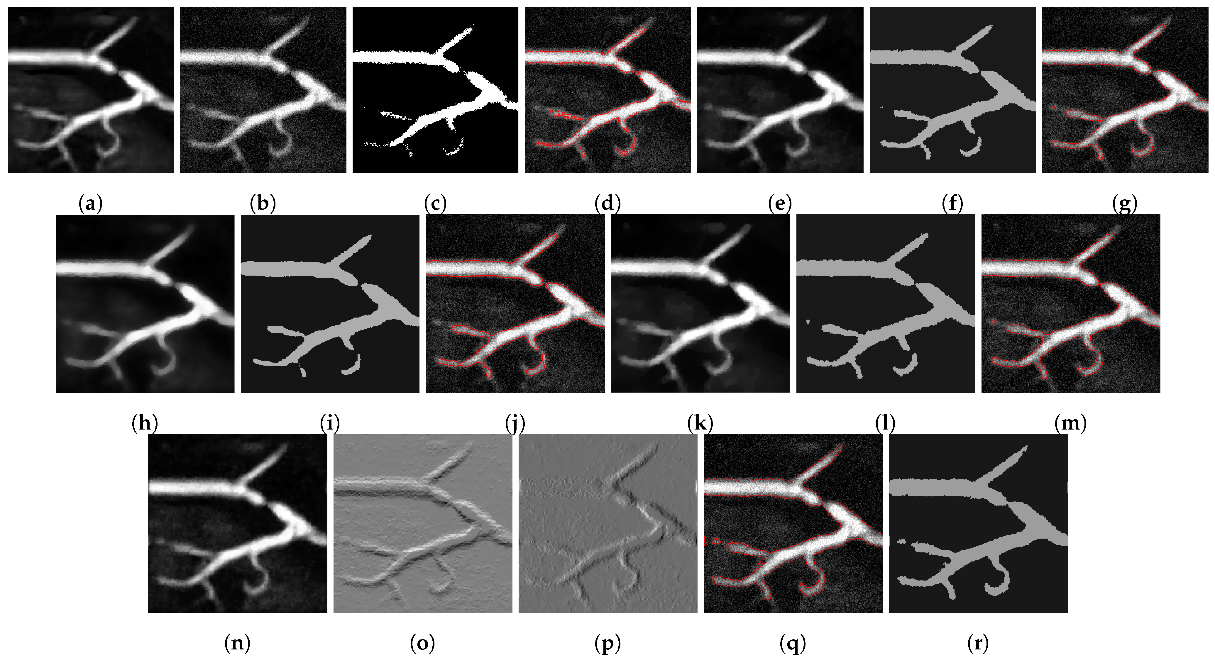 On a Variational and Convex Model of the Blake–Zisserman Type for Segmentation of Low-Contrast ...