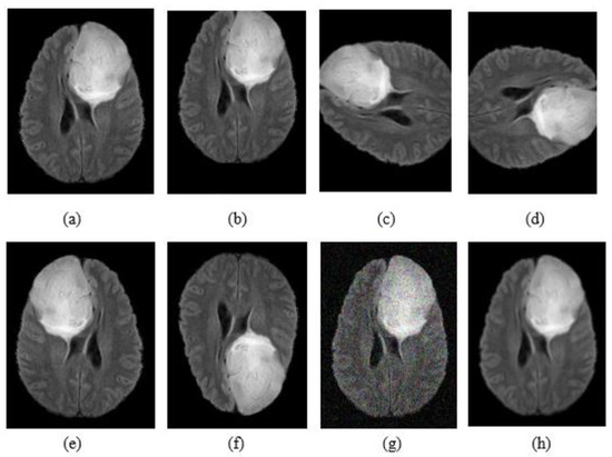 Brain Tumor Segmentation Based on Deep Learning’s Feature Representation