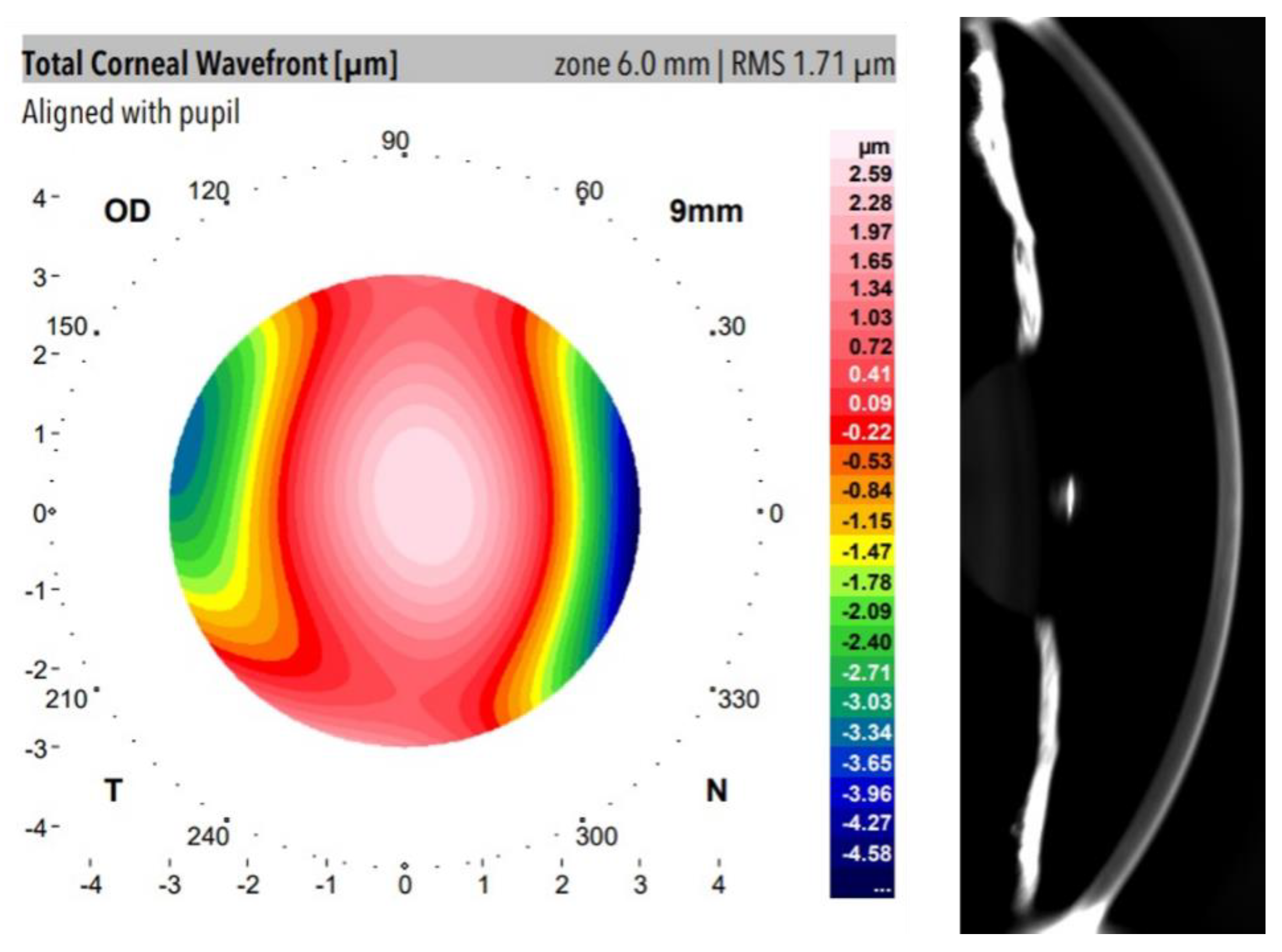 On the Relationship between Corneal Biomechanics, Macrostructure, and Optical Properties