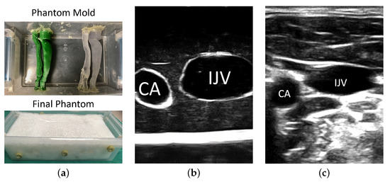 J. Imaging | Free Full-Text | Towards a First-Person Perspective Mixed ...