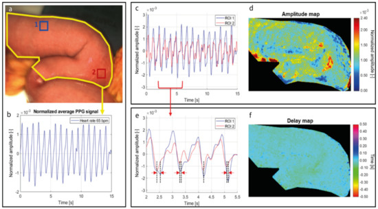 Journal of Imaging | An Open Access Journal from MDPI