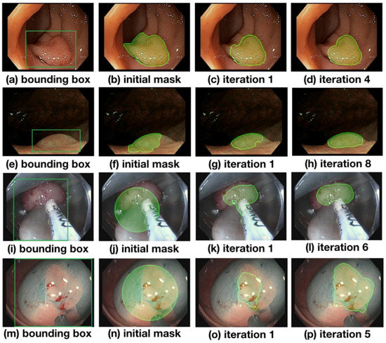 Weakly Supervised Polyp Segmentation in Colonoscopy Images Using Deep Neural Networks