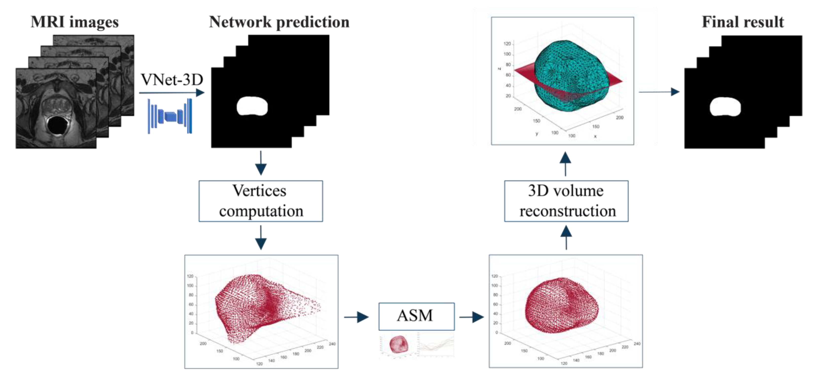 Integration of Deep Learning and Active Shape Models for More Accurate Prostate Segmentation in ...