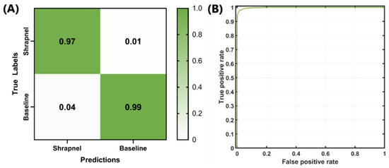 Comparison of Ultrasound Image Classifier Deep Learning Algorithms for Shrapnel Detection