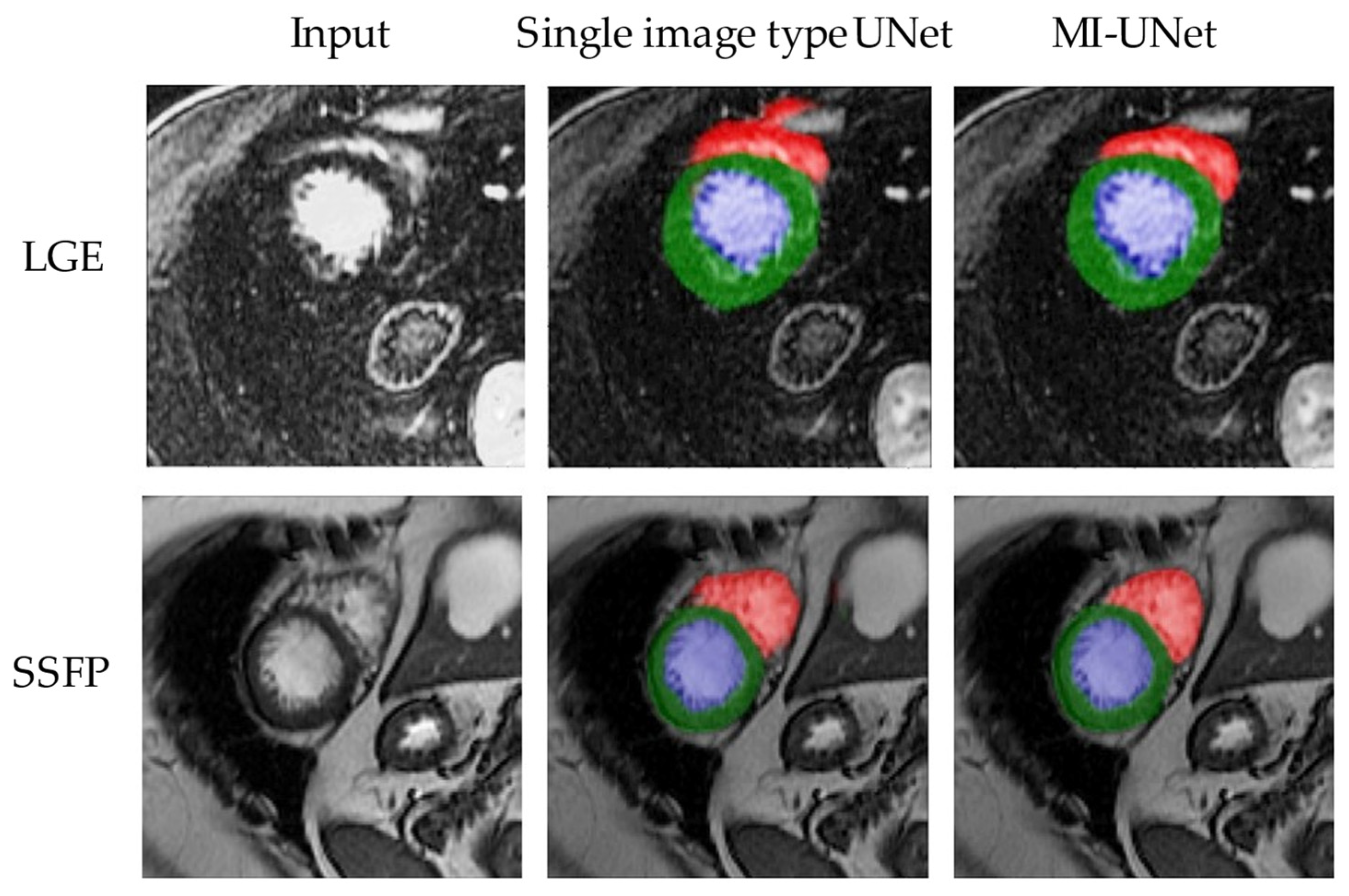 Deep Neural Network for Cardiac Magnetic Resonance Image Segmentation