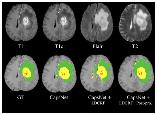 Journal of Imaging | An Open Access Journal from MDPI