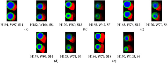 Journal of Imaging | An Open Access Journal from MDPI