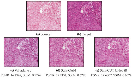 StainCUT: Stain Normalization with Contrastive Learning