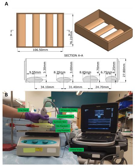 Training Ultrasound Image Classification Deep-Learning Algorithms for Pneumothorax Detection ...