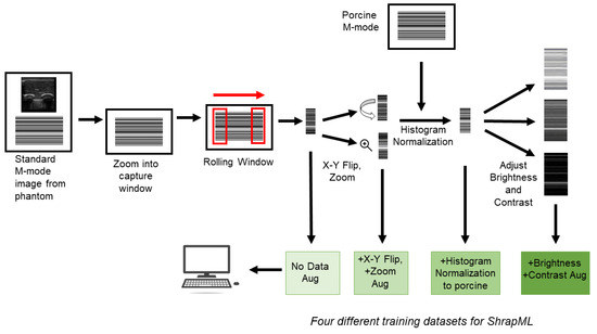 Training Ultrasound Image Classification Deep-Learning Algorithms for Pneumothorax Detection ...