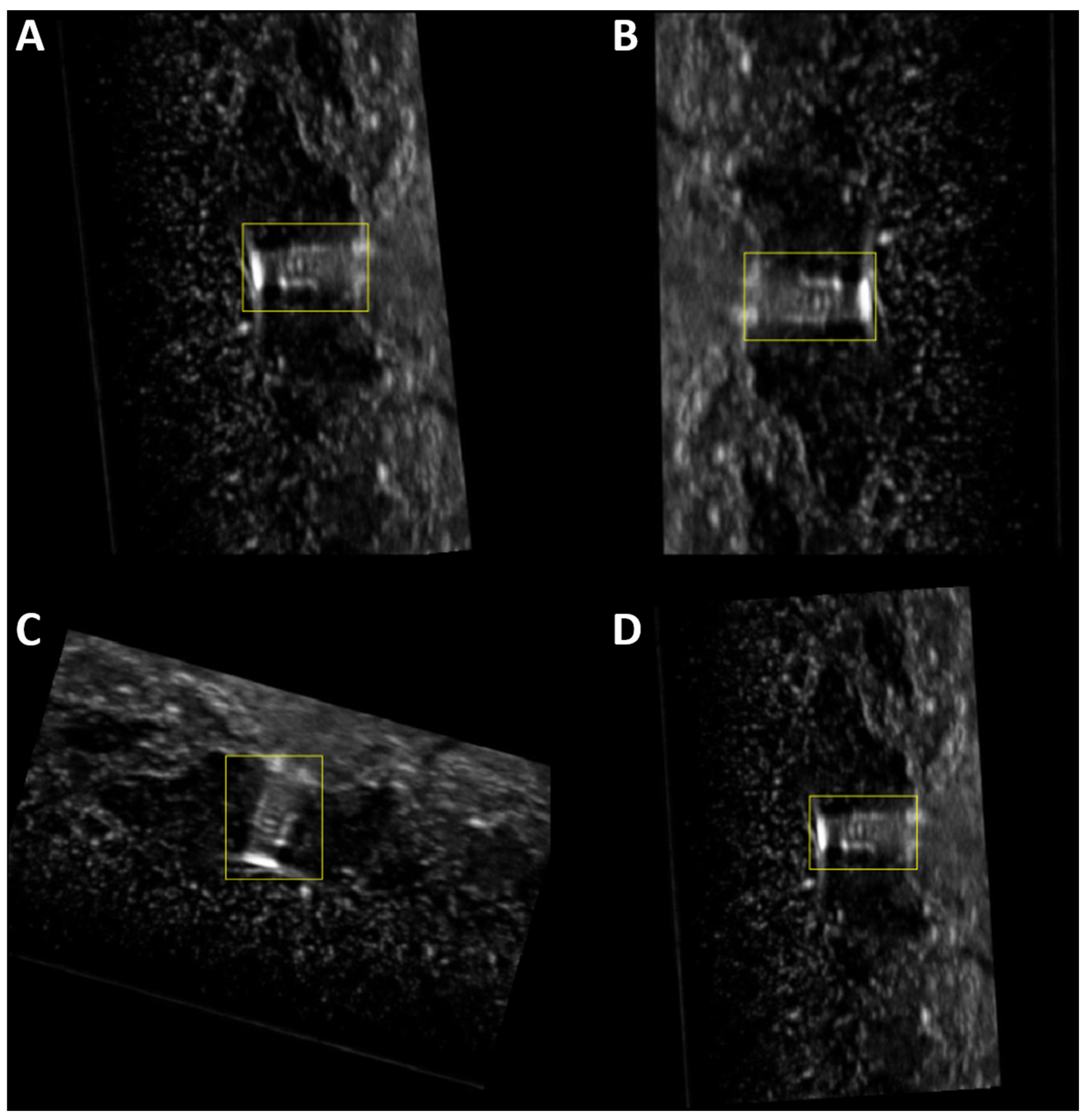Evaluation of an Object Detection Algorithm for Shrapnel and ...