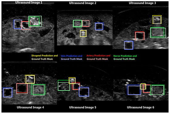 Evaluation of an Object Detection Algorithm for Shrapnel and Development of a Triage Tool to ...