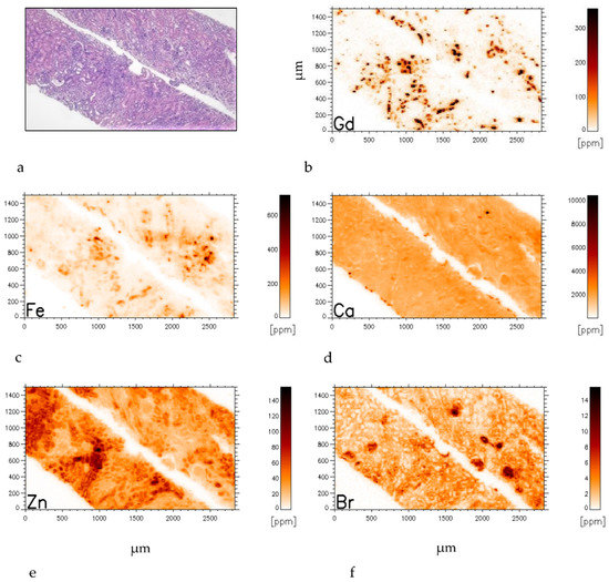 Gadolinium and Bio-Metal Association: A Concentration Dependency Tested ...