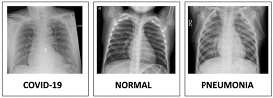 Comprehensive Survey of Machine Learning Systems for COVID-19 Detection