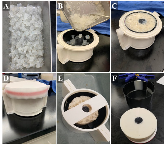 Using an Ultrasound Tissue Phantom Model for Hybrid Training of Deep ...