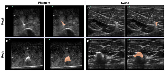 Using an Ultrasound Tissue Phantom Model for Hybrid Training of Deep Learning Models for ...