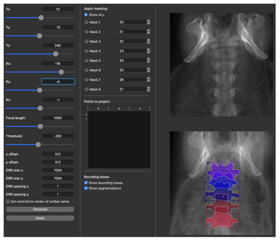 X23D—Intraoperative 3D Lumbar Spine Shape Reconstruction Based on ...