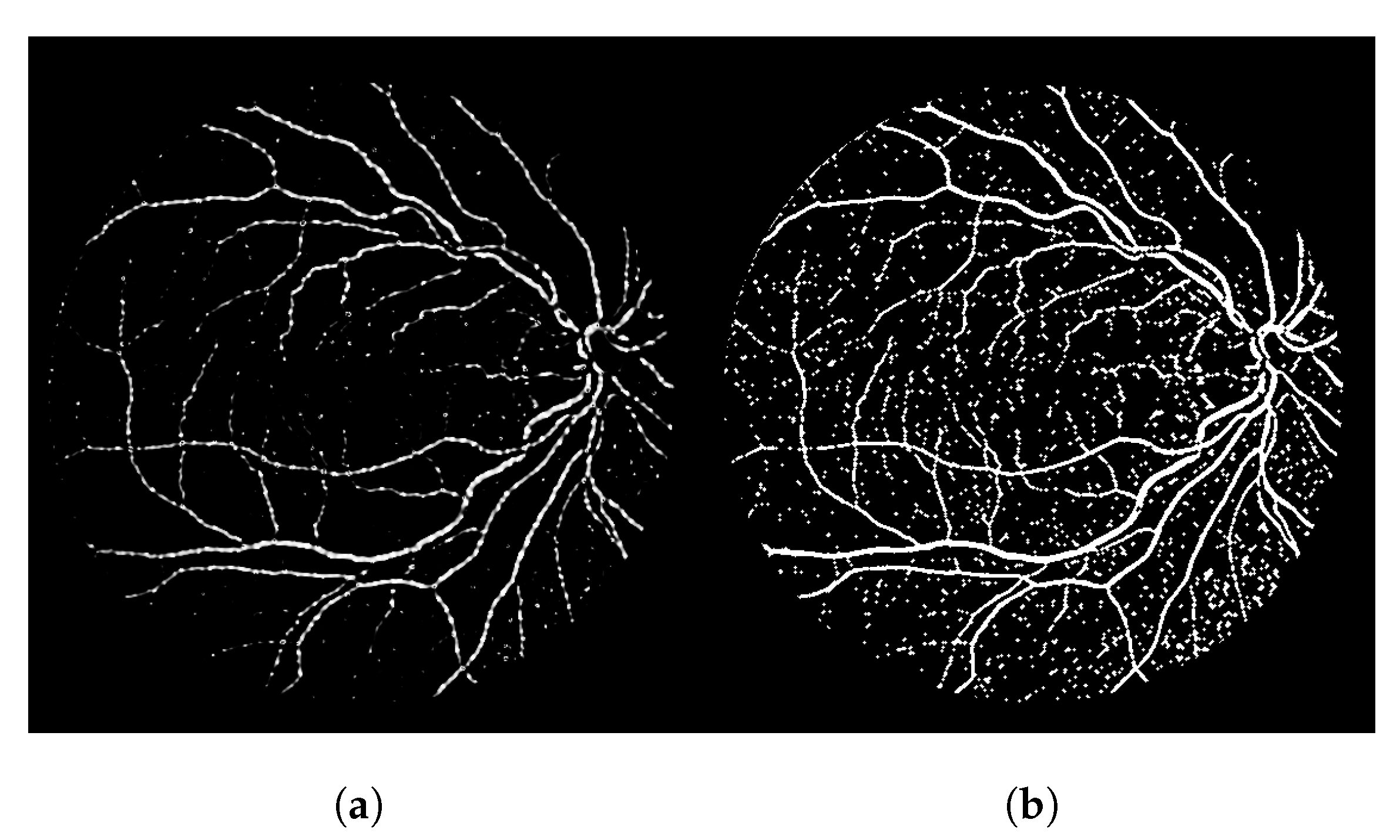 Local-Sensitive Connectivity Filter (LS-CF): A Post-Processing ...
