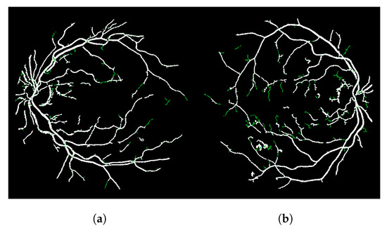 Local-Sensitive Connectivity Filter (LS-CF): A Post-Processing ...