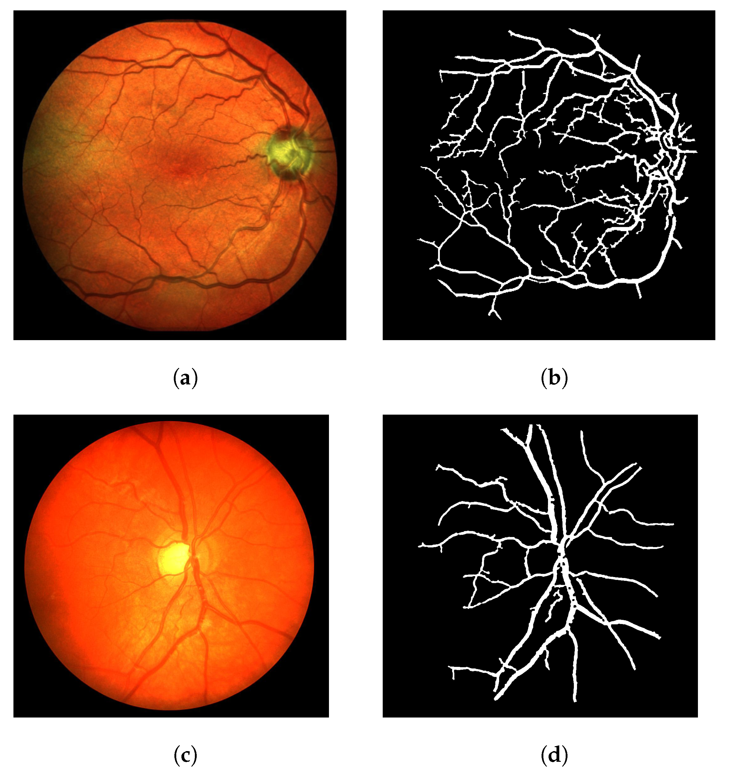Local-Sensitive Connectivity Filter (LS-CF): A Post-Processing ...
